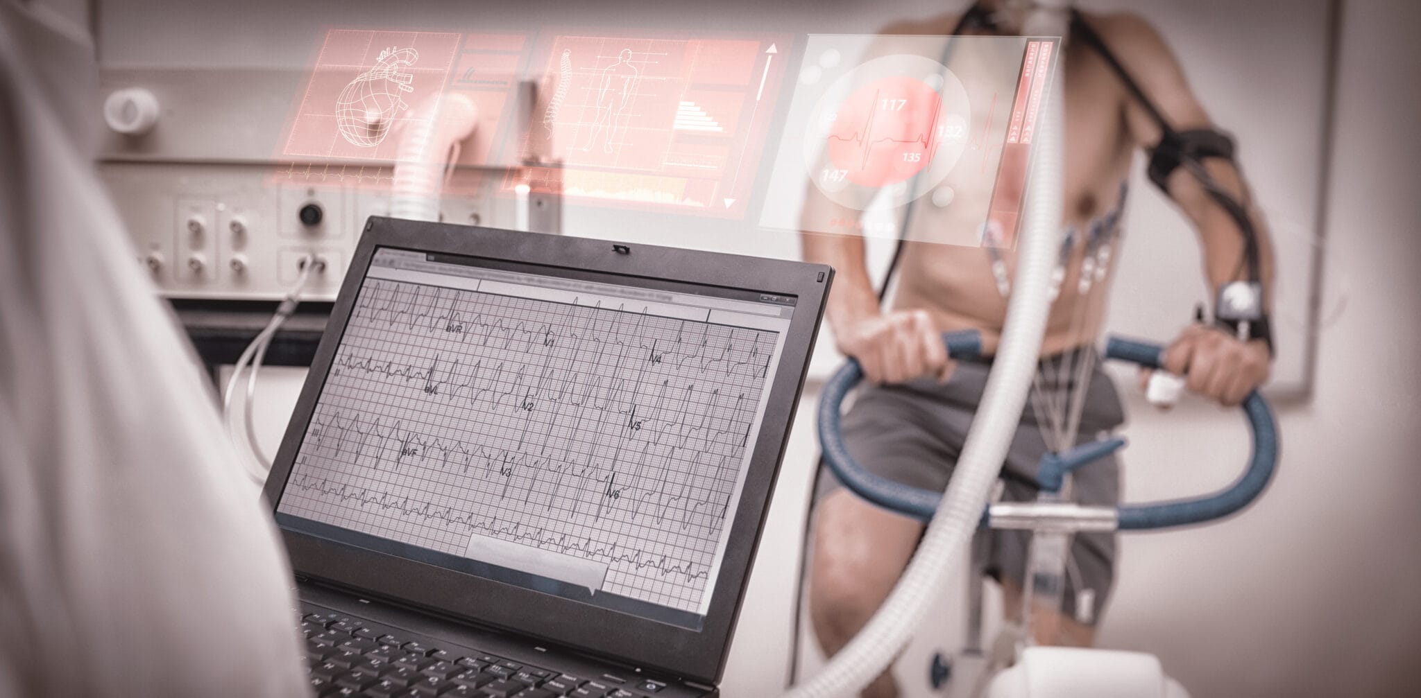 Coronary Artery Disease (CAD) - CubaHeal